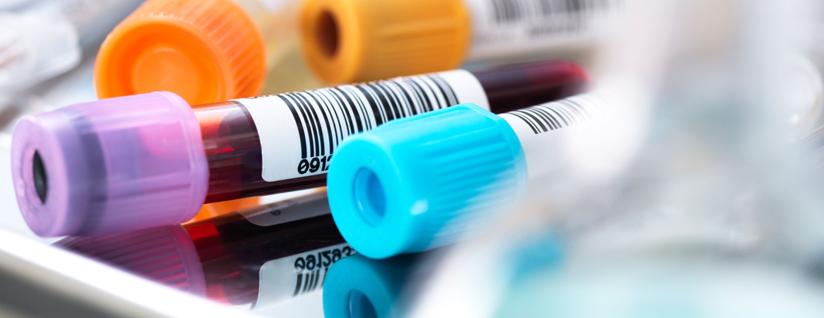 Complement component 3 (C3) | UCSF Health