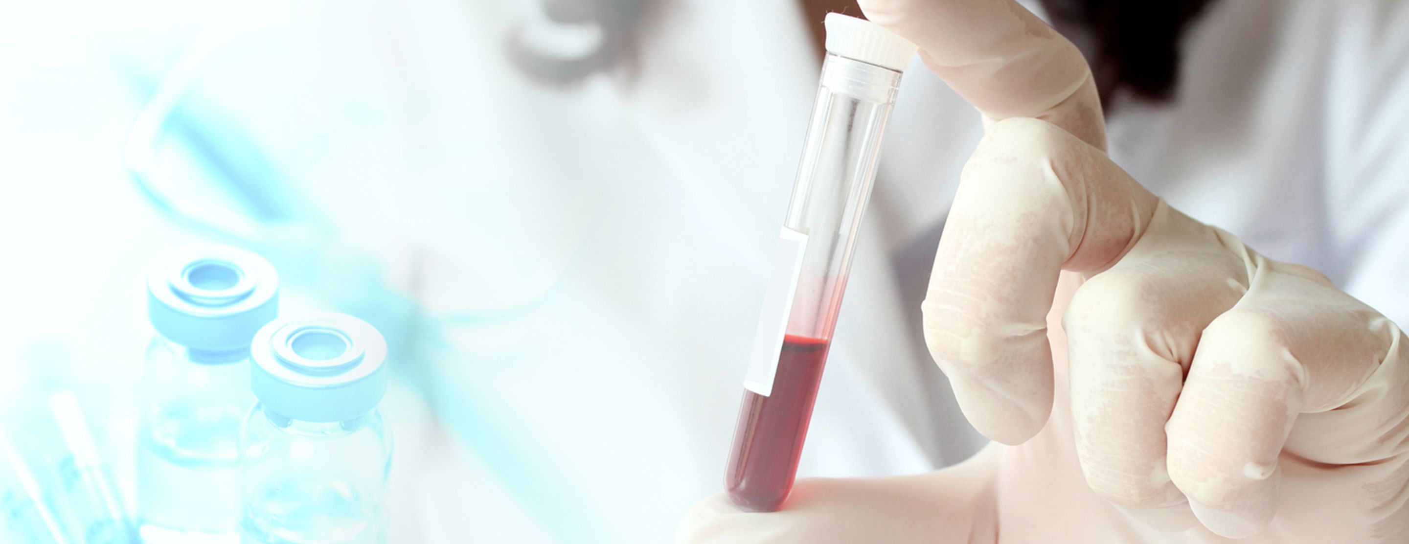 Platelet aggregation test | UCSF Health
