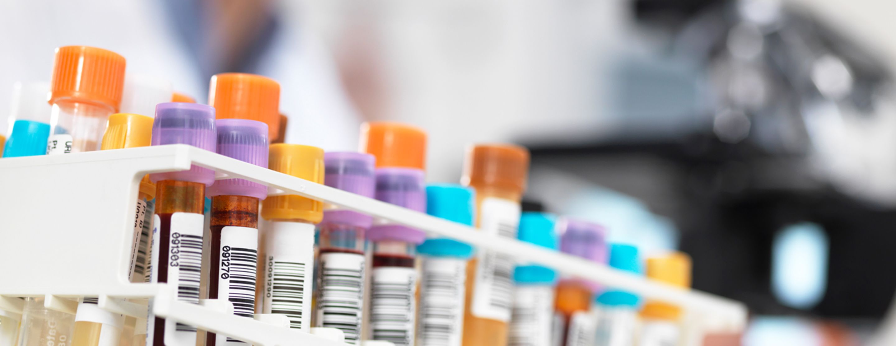 Quadruple screen test | UCSF Health