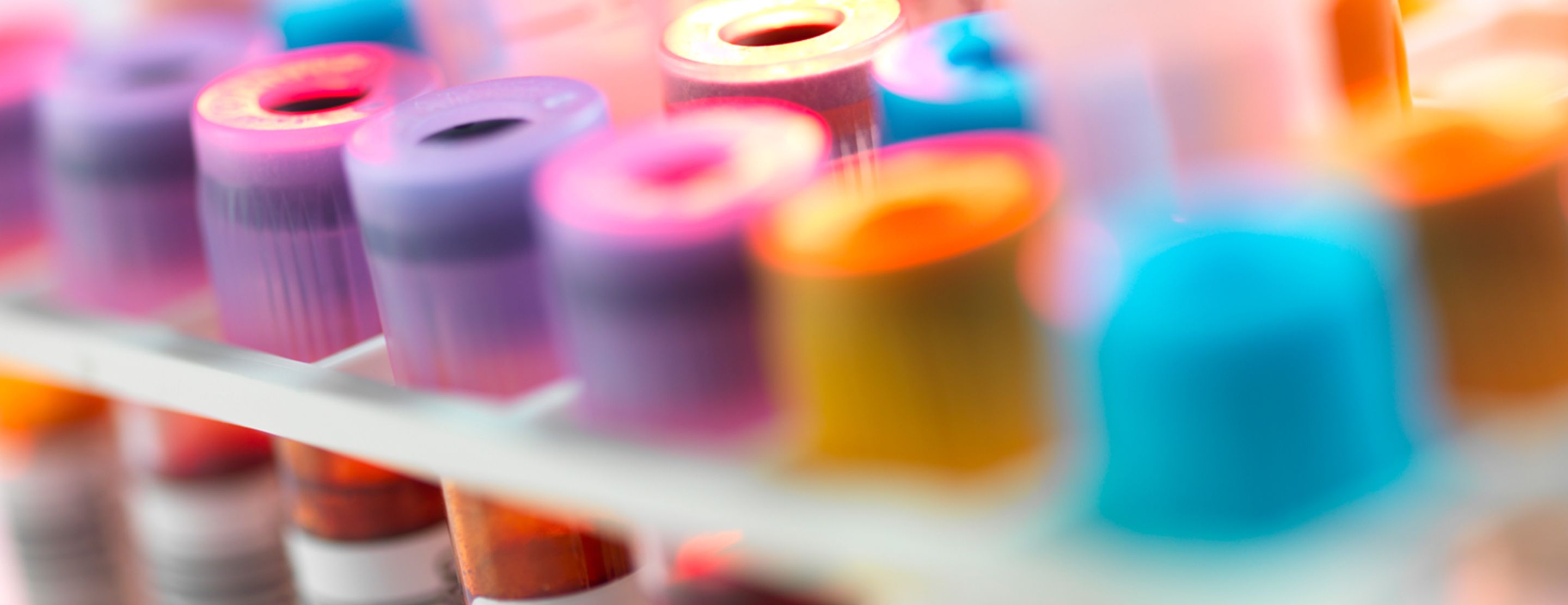 Schilling test | UCSF Health