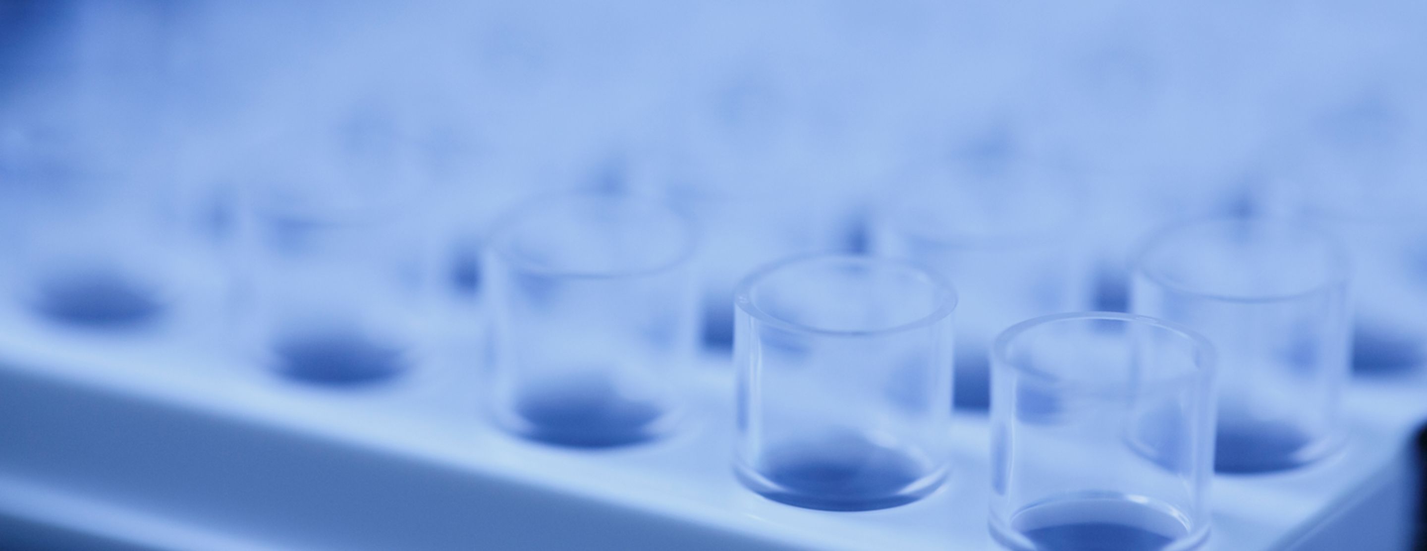 Serotonin blood test | UCSF Health