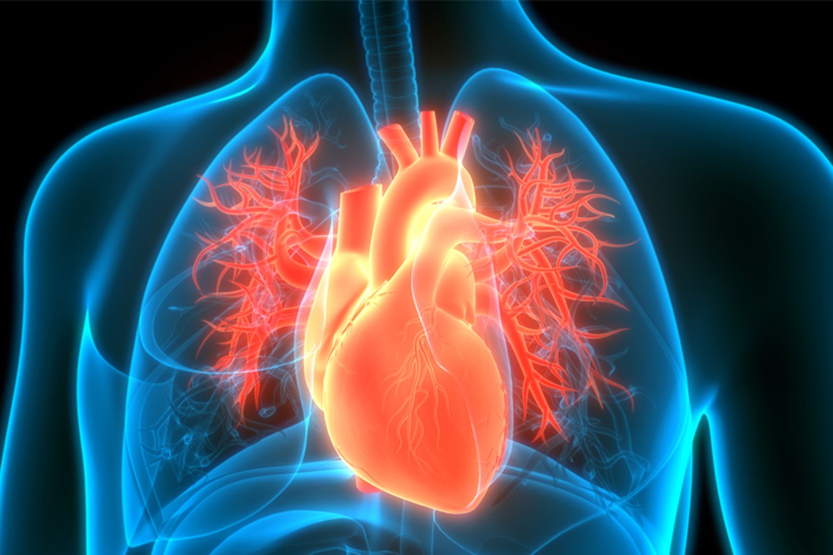 CardioMEMS | Conditions & Treatments | UCSF Health