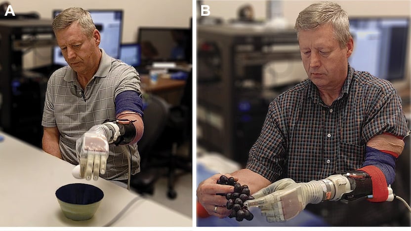 UChicago neuroscientists expand possibilities for realistic prosthetic ...