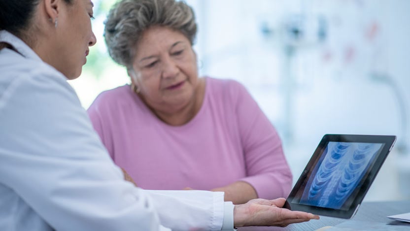 New research leads to better outcomes for lung cancer patients ...