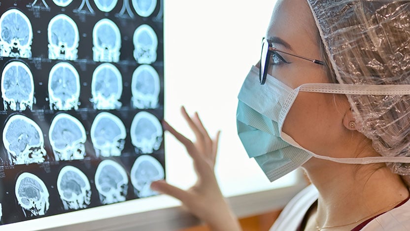 Cáncer cerebral: Aspectos a tener en cuenta y preguntas frecuentes