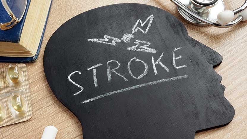 Strokes & other neurovascular conditions: What you need to know ...