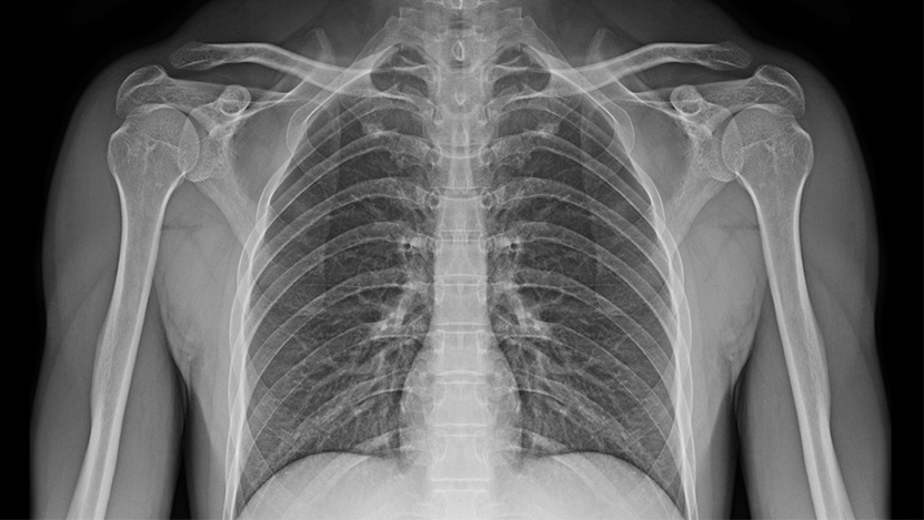 MIDRC lends medical imaging expertise to new biomedical data program ...