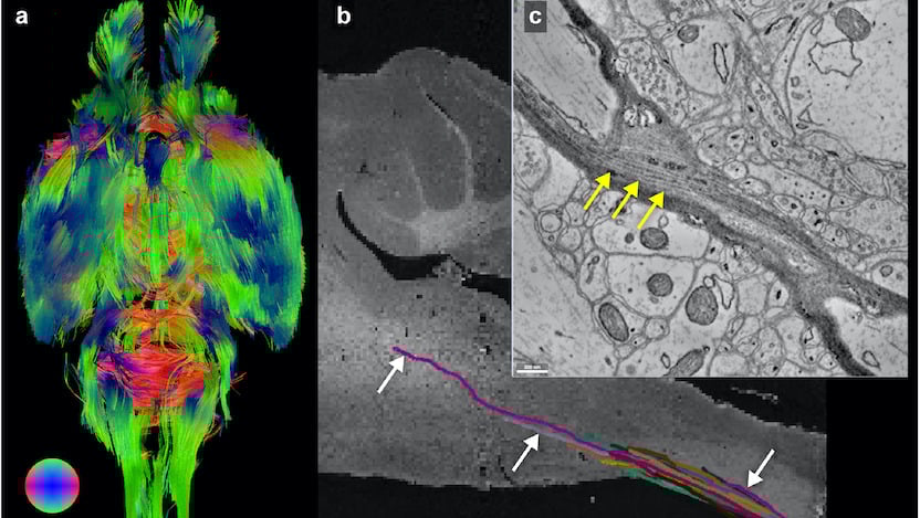 Mouse brain imaged from the microscopic to the macroscopic level ...