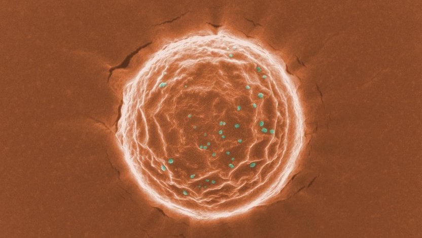 University of Chicago scientists design “Nanotraps” to catch and clear ...