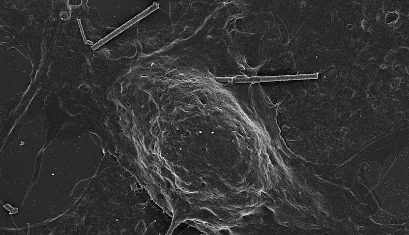Nanowires let scientists control nerve cells with light - UChicago Medicine
