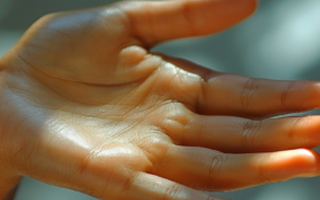Common Congenital Hand Disorders: Understanding Causes, Treatment ...
